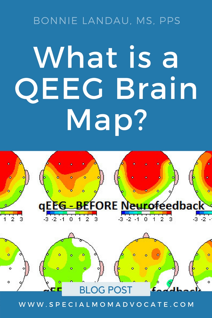 What is a QEEG Brain Map? | Special Mom Advocate